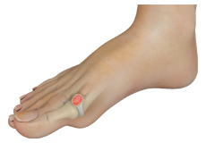 Best foot ankle Surgeon near me in Delhi, Leg Injury Doctor and Leg ...